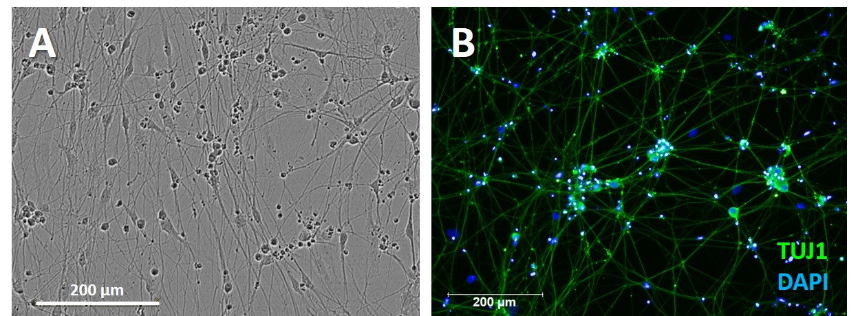 Rat Dorsal Root Ganglion Neurons (rDRGN)