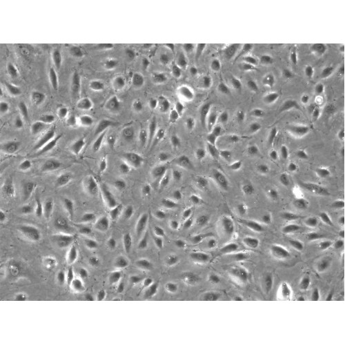 Human Brain Microvascular Endothelial Cells (HBMVEC)