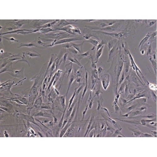 Human Hepatic Stellate Cells- Adult (HHSC)