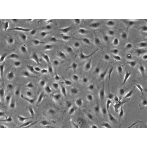 Human Lung Microvascular Endothelial Cells (HLMVEC)