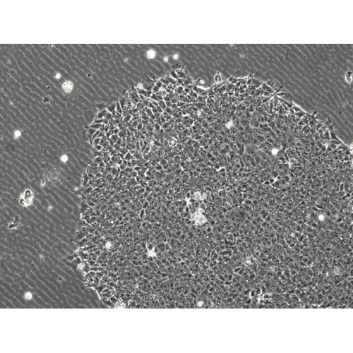 Human iPS Cell Line (Amyotrophic Lateral Sclerosis)