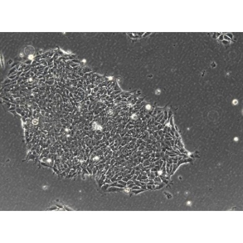 Human iPS Cell Line (Parkinson's Disease)