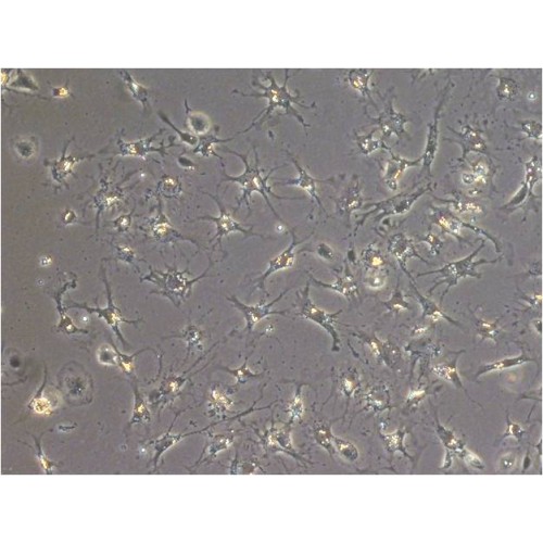 Mouse Hepatic Stellate Cells (MHSC)