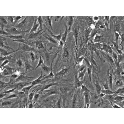 Rat Mesenchymal Stem Cells - Bone Marrow (RMSC-bm)