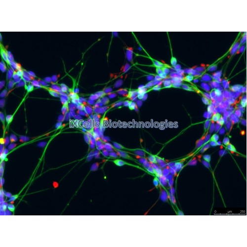 Human Motor Neurons (iPSC-derived, SOD1 mutant, A4V)