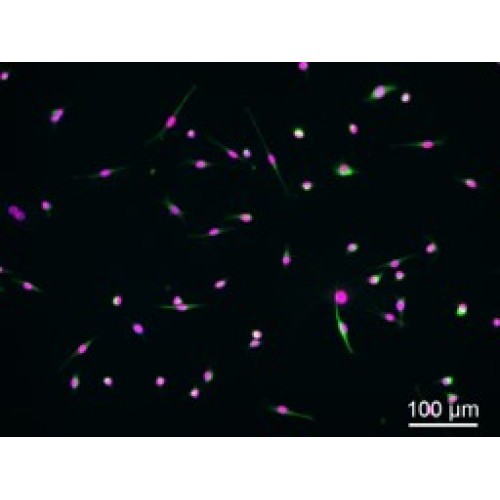 Mouse Skeletal Muscle Myoblasts (MSkMM)